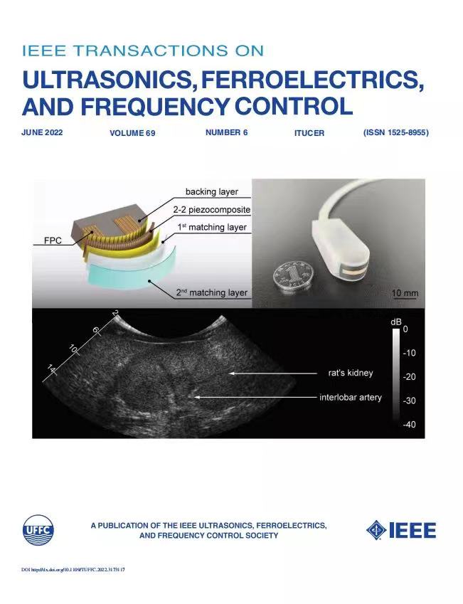 我院研究生论文被选为IEEE UFFC杂志封面文章